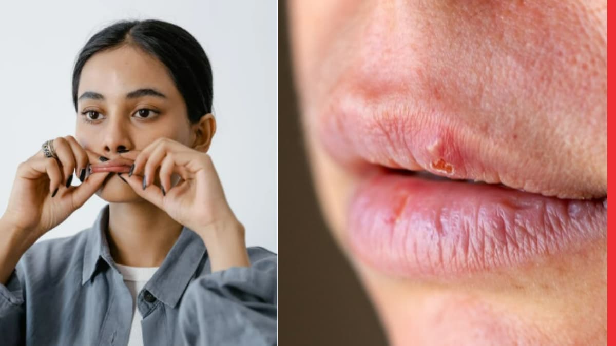 This is how you can get rid of tanned lips