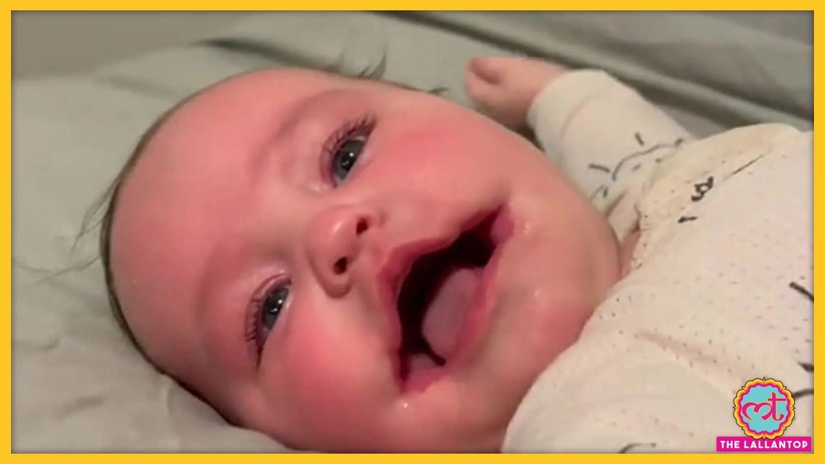 what is Bilateral Macrostomia and how to treat it