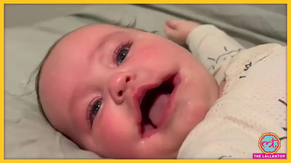 what is Bilateral Macrostomia and how to treat it