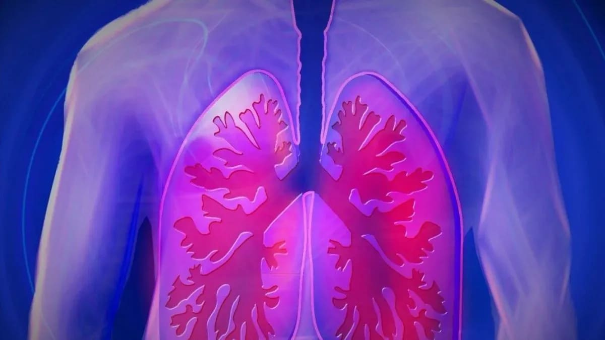 what is pneumothorax and how to treat it